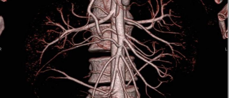 Anatomy and Function of the Celiac Artery – The University of Chicago ...